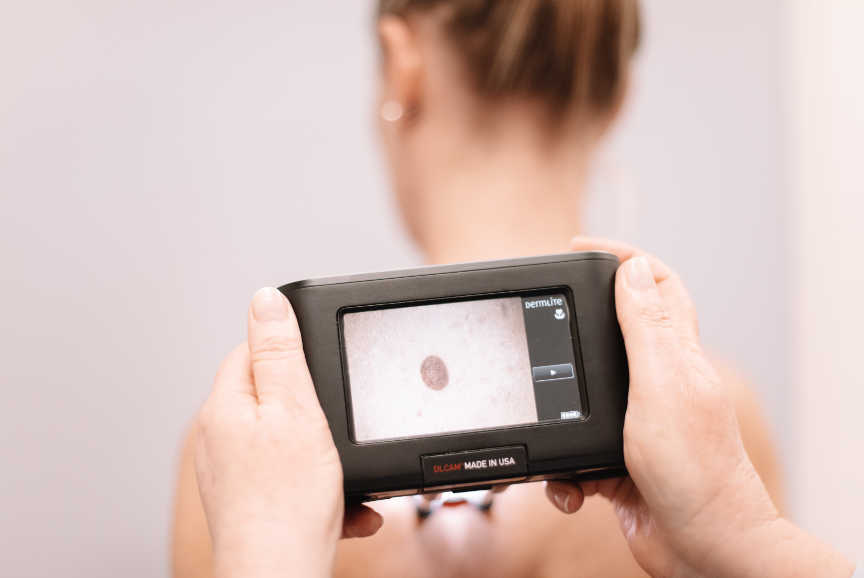 MoleMap is providing the gold standard for melanoma detection and ...